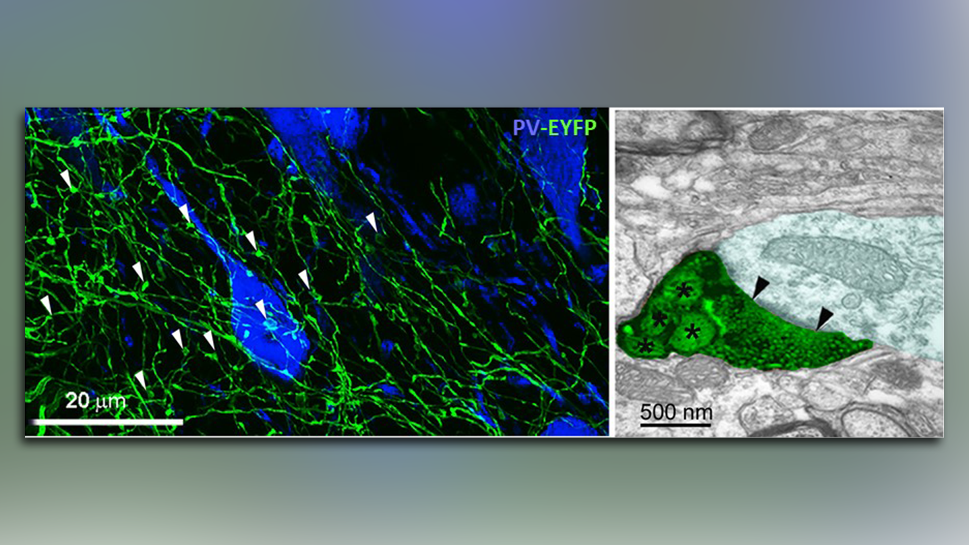 A KOKI kutatói új, régióspecifikus agykérgi kommunikációs csatornát ...